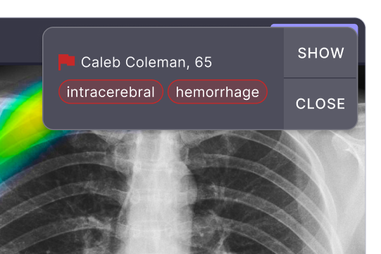 deepcOS for Radiologists
